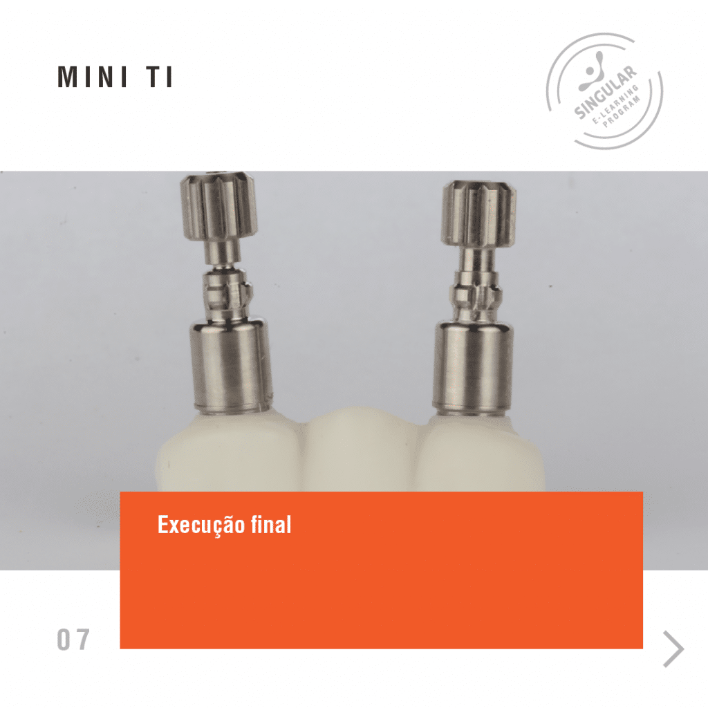 Você sabe qual a função do Mini Ti e como usá-lo? - Singular Implants